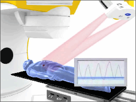 La radioterapia en el cáncer de pulmón
